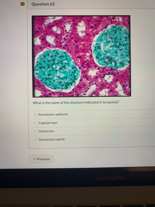 Solved Question 62 What is the name of the structure | Chegg.com