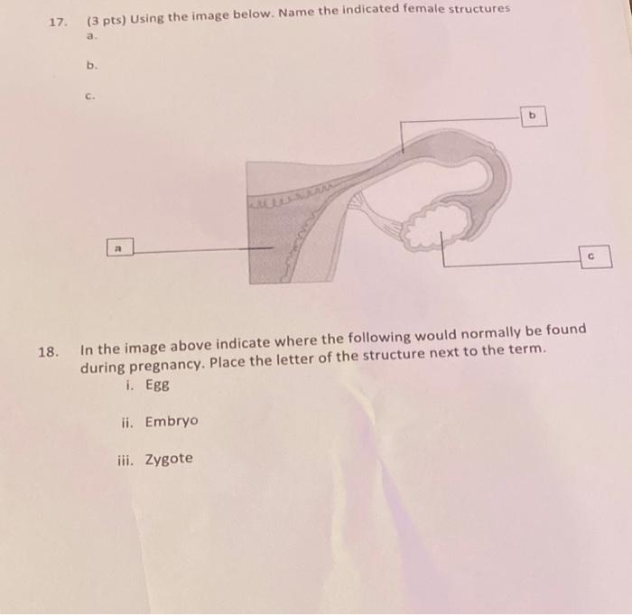 Solved 17. (3 pts) Using the image below. Name the indicated | Chegg.com