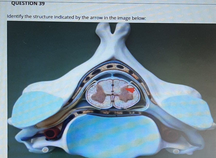 Solved QUESTION 41 Identify the structure indicated by the | Chegg.com
