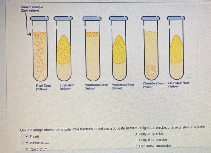 Solved Growth Example Dark Yellow 1f E Coli Deep