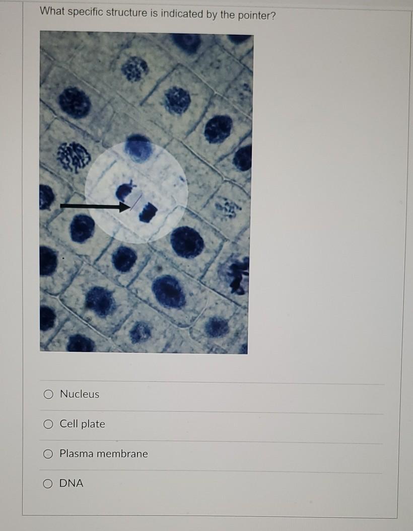 Solved What specific structure is indicated by the pointer? | Chegg.com