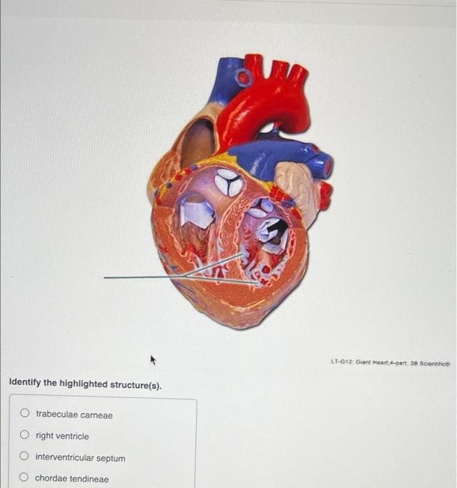 Solved Identify the highlighted structure(s). O trabeculae | Chegg.com