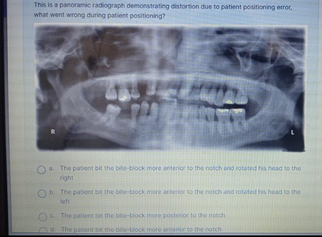 Solved This is a panoramic radiograph demonstrating | Chegg.com