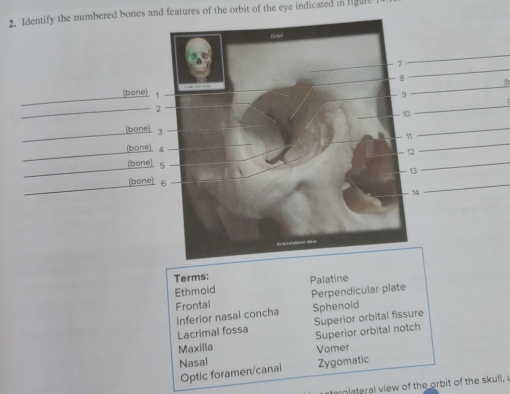Solved Identify the numbered bones and features of the orbit | Chegg.com