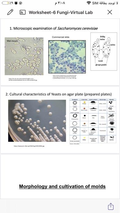 Solved Yeast Morphology and cultural characteristics c. | Chegg.com