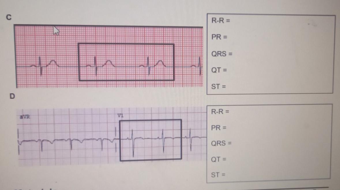Solved Activity 1. Calculate the R-R, PR, QRS, QT, and ST | Chegg.com