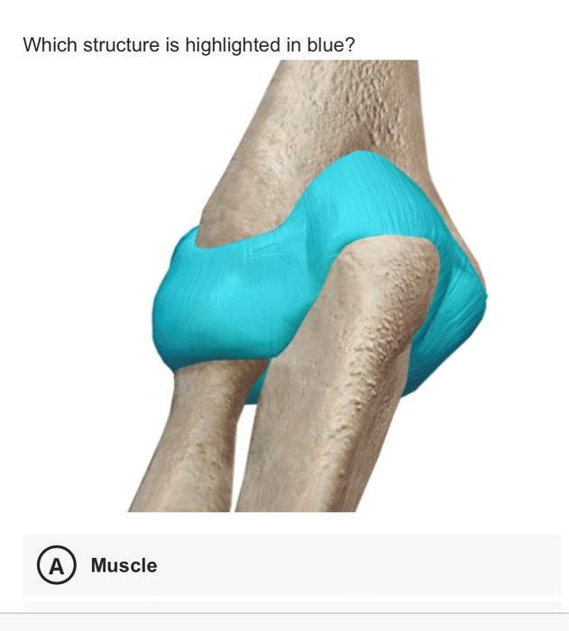 Solved Which structure is highlighted in blue? (A) | Chegg.com