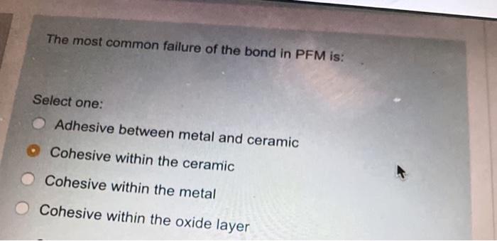 Solved The most common failure of the bond in PFM is: Select | Chegg.com