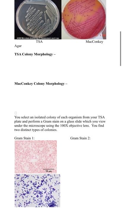 Solved Laboratory Exercise 13: Bacterial Isolation and | Chegg.com
