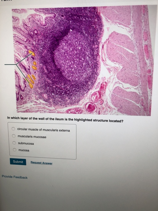 Solved In which layer of the wall of the ileum is the | Chegg.com