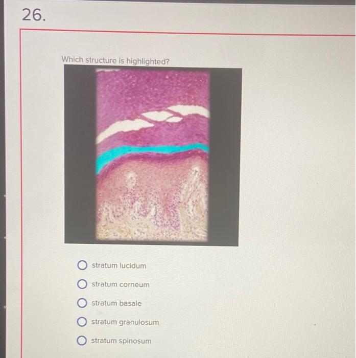 Solved 26. Which structure is highlighted? stratum lucidum | Chegg.com