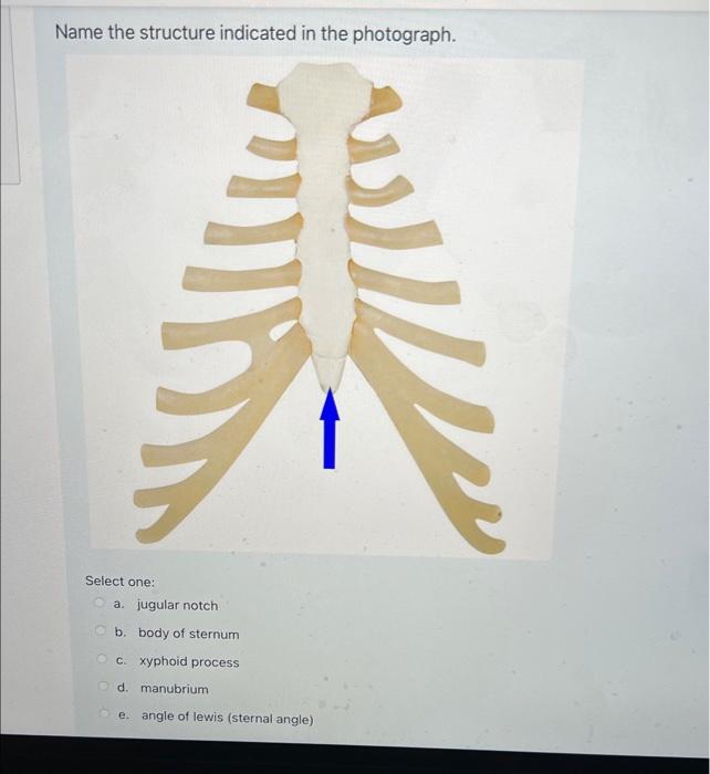 Solved Name the structure indicated in the photograph. | Chegg.com