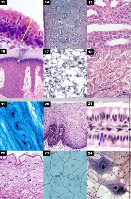 Solved Major type Specific type Simple squamous epithelium | Chegg.com