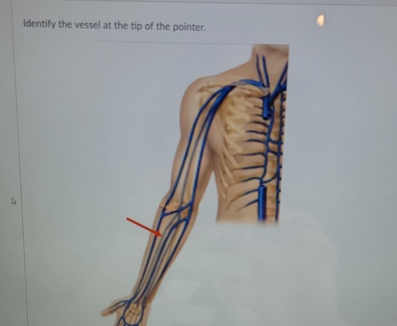 Solved Identify the vessel at the tip of the | Chegg.com