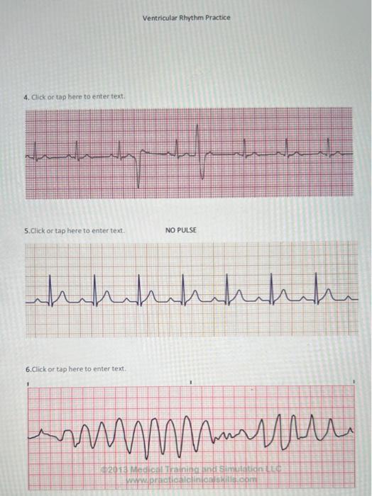 Analyze each rhythm strip. Interpret the rhythm. 1. | Chegg.com
