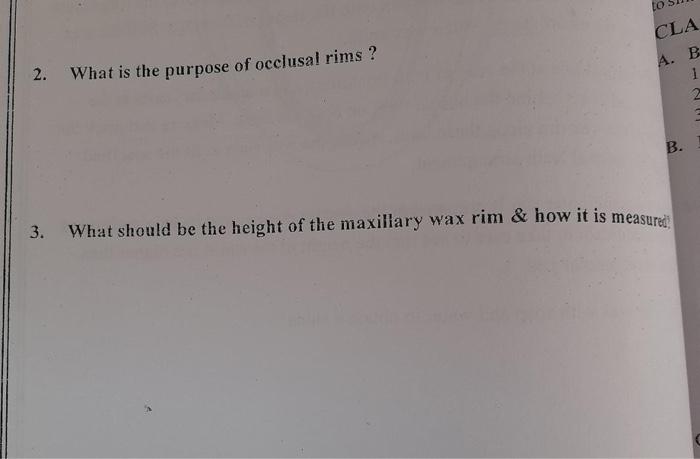 Solved What are the requirements of teříporary record bases | Chegg.com