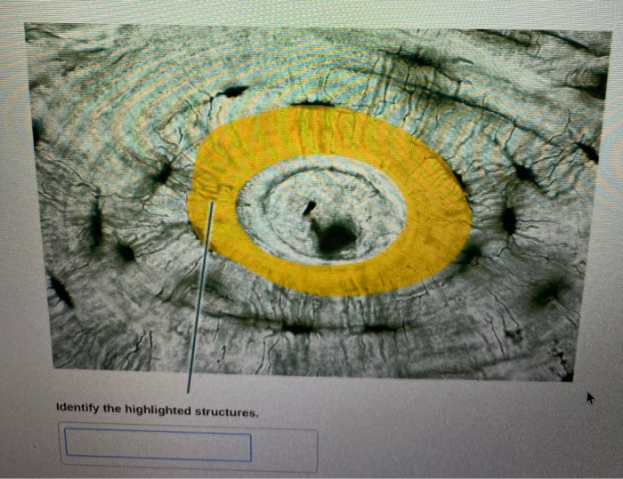 Solved Identify the highlighted structures. | Chegg.com