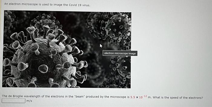 Solved An electron microscope is used to image the Covid 19 | Chegg.com