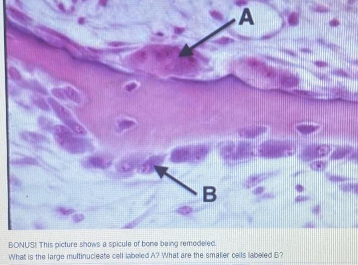Solved A А B BONUS! This picture shows a spicule of bone | Chegg.com