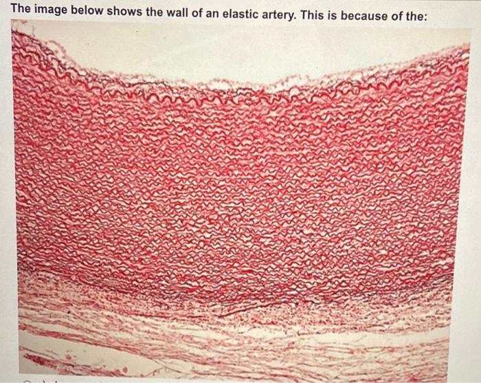 Solved The image below shows the wall of an elastic artery. | Chegg.com