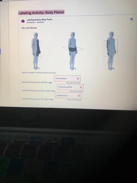 Solved Labeling Activity: Body Planes Labeling Activity Body | Chegg.com