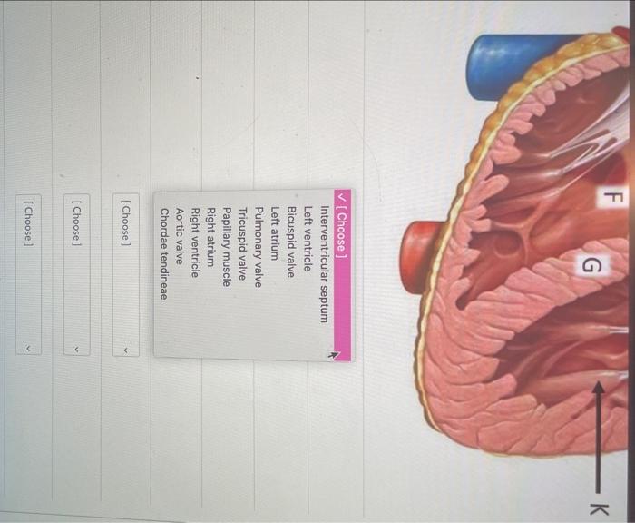Solved [Choose] Coronary arteries Superior vena cava | Chegg.com