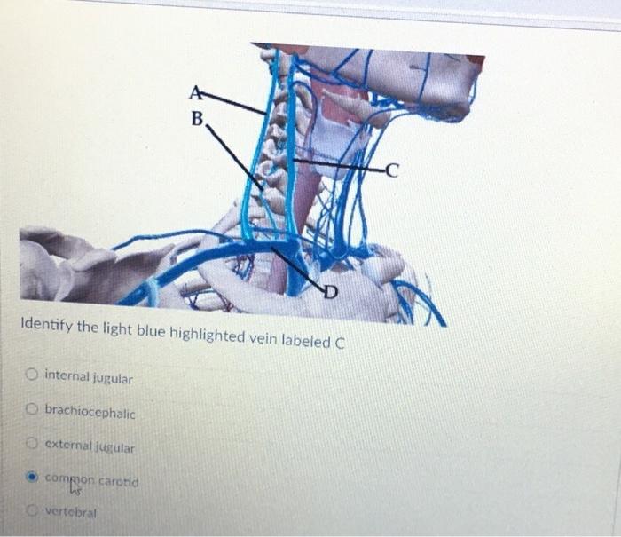Solved A B В Le D Identify the light blue highlighted vein | Chegg.com