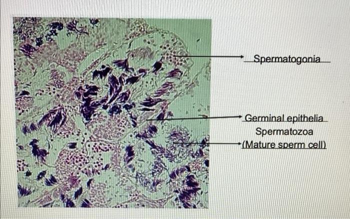 Solved Spermatogonia Germinal epithelia Spermatozoa - | Chegg.com