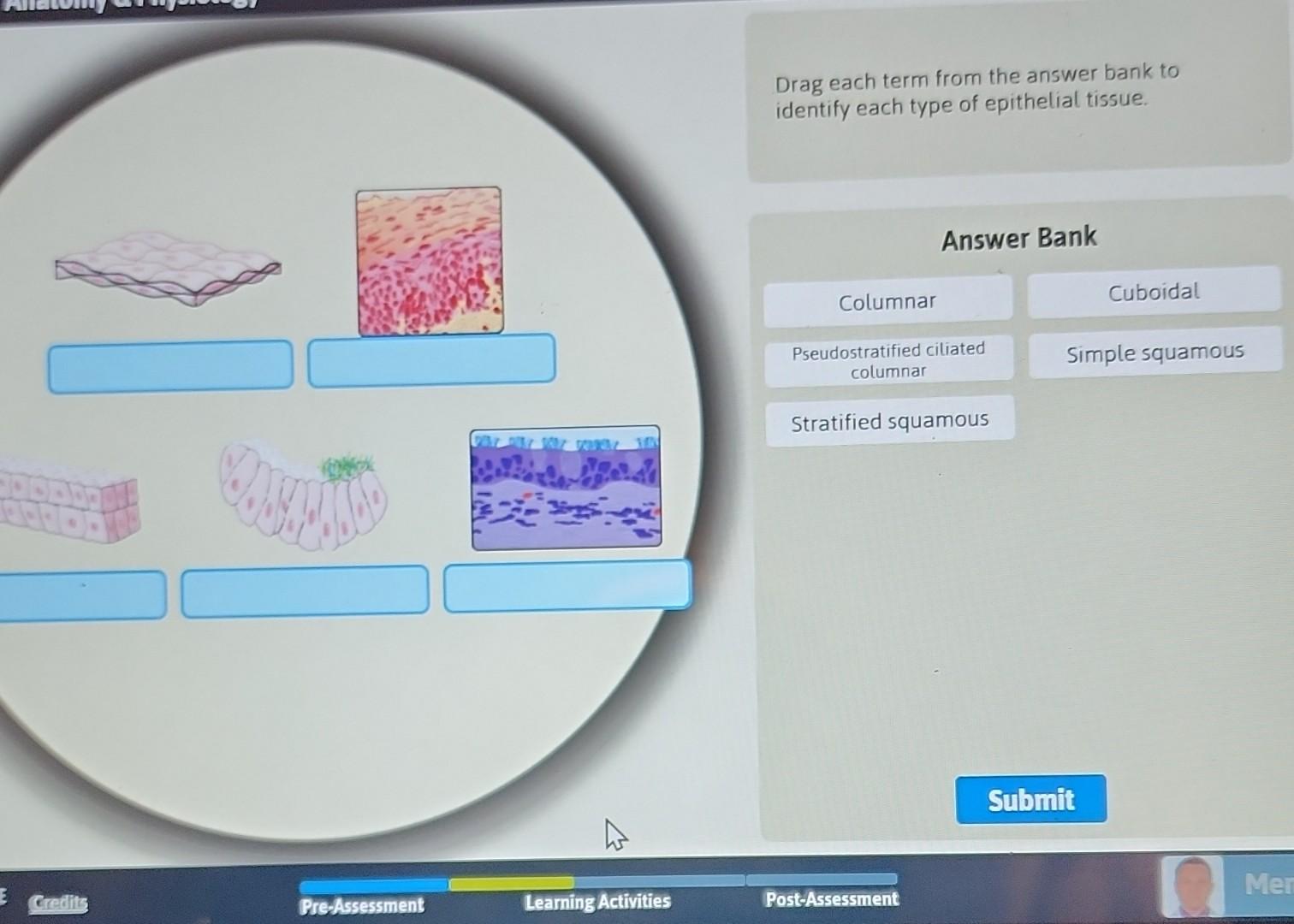 Solved Drag each term from the answer bank to identify each | Chegg.com