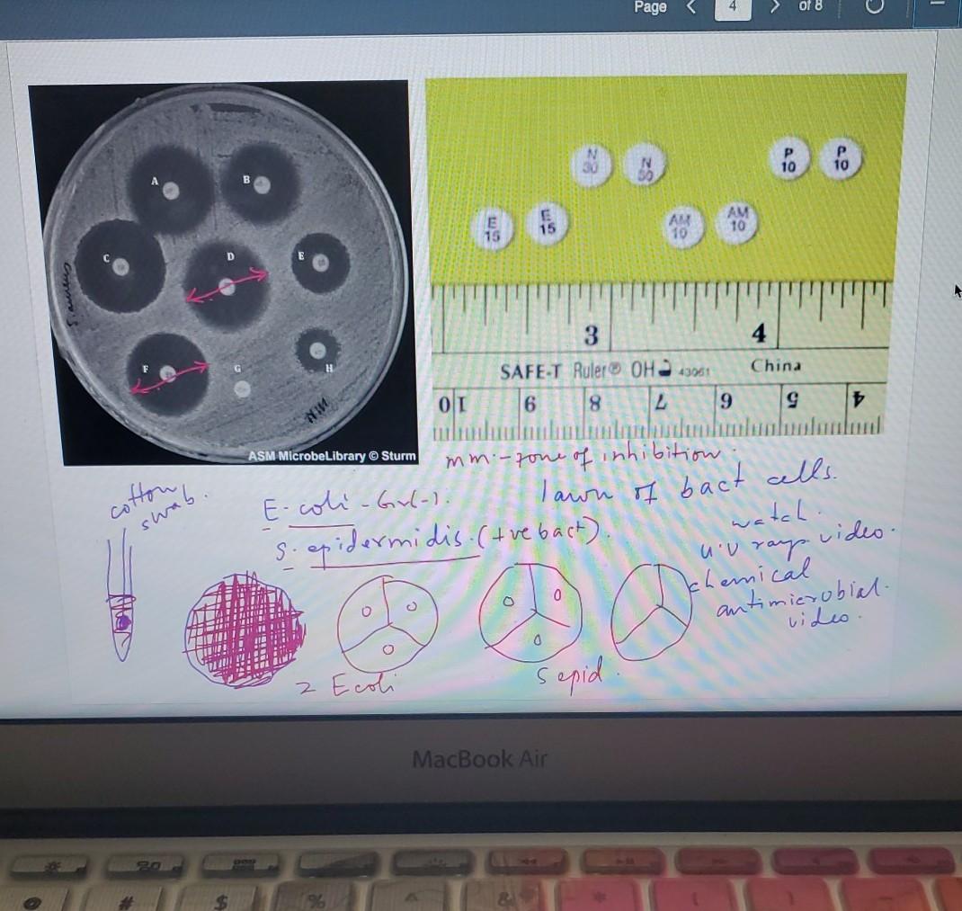 Solved Your Name Experiment Date Expt # 19. Antibiotic Disc | Chegg.com