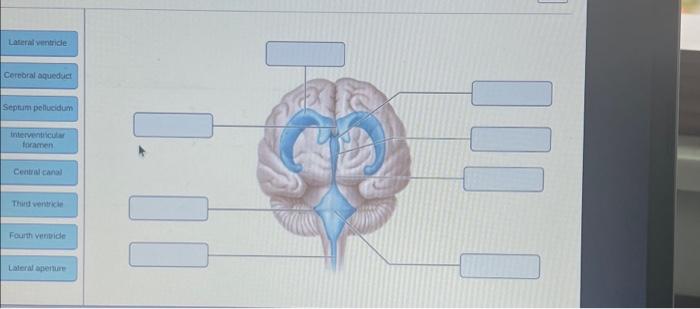 Solved Lateral ventricle Cerebral aqueduct Septum pellucidum | Chegg.com