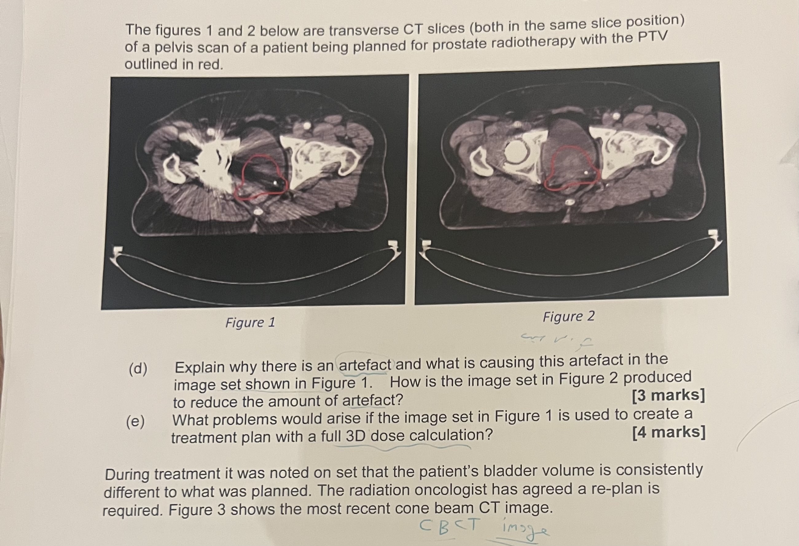 Solved Medical physics , ﻿radiotherapy field, The figures 1 | Chegg.com