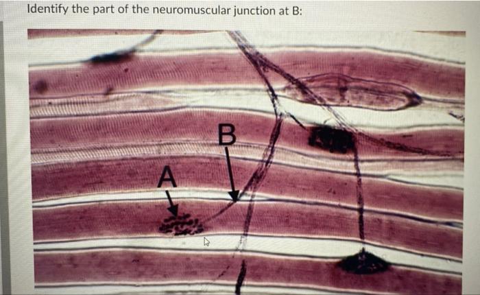 Solved Identify the part of the neuromuscular junction at B: | Chegg.com