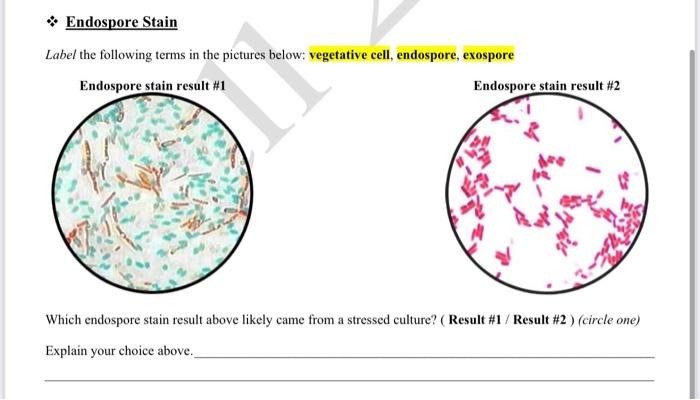Solved Label the following terms in the pictures below: | Chegg.com