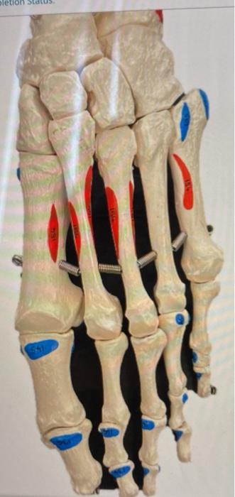 Solved Cuboid Lateral cuneiform Navicular Intermediate | Chegg.com