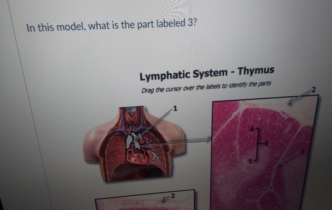 Solved In this model, what is the part labeled 3?Lymphatic | Chegg.com