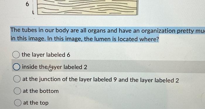 Solved The tubes in our body are all organs and have an | Chegg.com