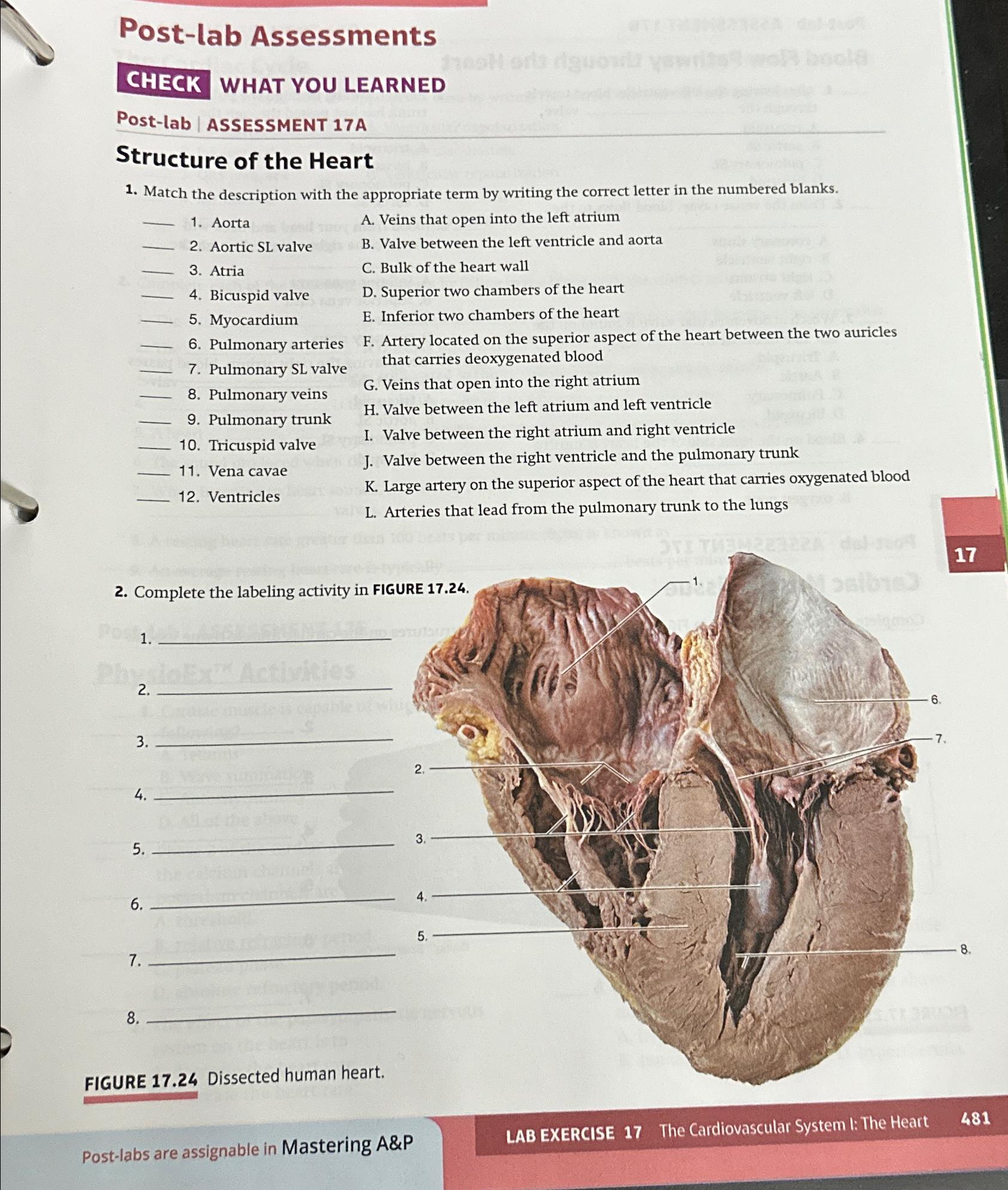 Solved Post-lab AssessmentsCHECK WHAT YOU LEARNEDPost-lab | | Chegg.com