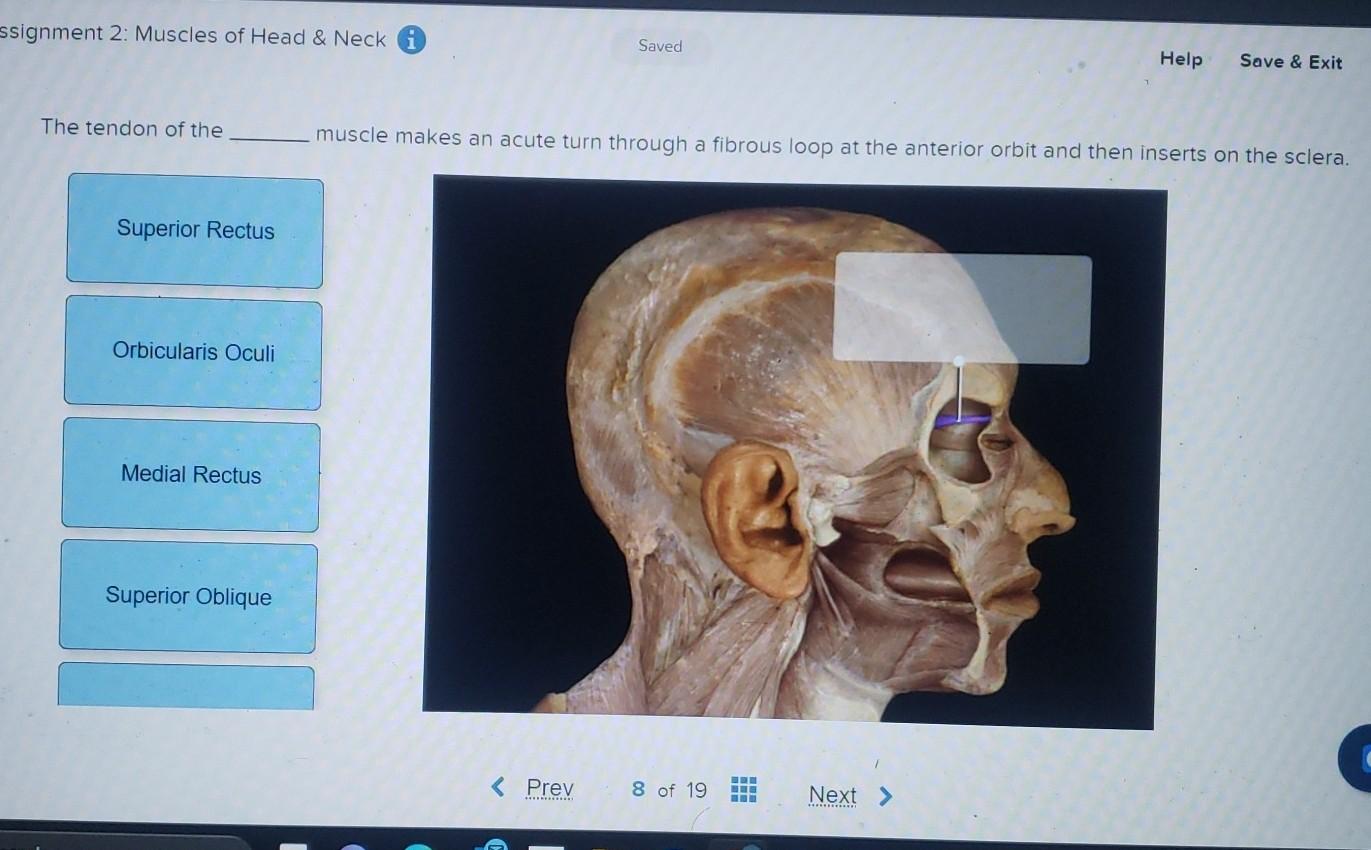 Solved ssignment 2: Muscles of Head & Neck iSavedHelpSave & | Chegg.com Solved ssignment 2: Muscles of Head & Neck iSavedHelpSave & | Chegg.com