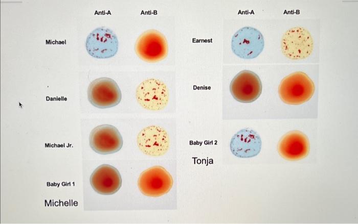 Solved A person with Type A+ blood will have which of the | Chegg.com