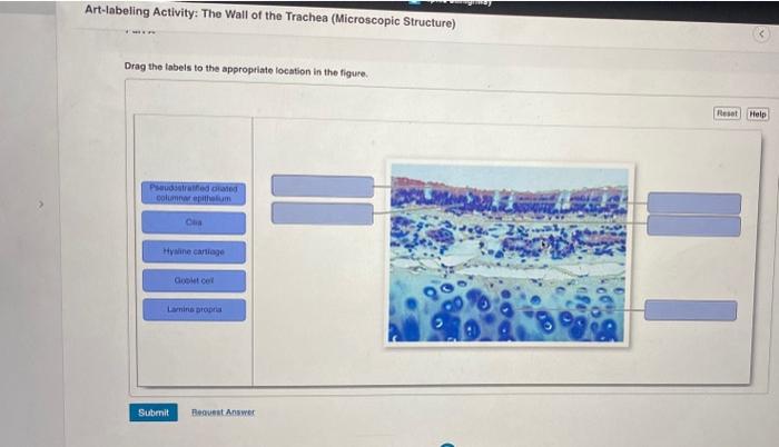 Solved Art-labeling Activity: The Wall of the Trachea | Chegg.com