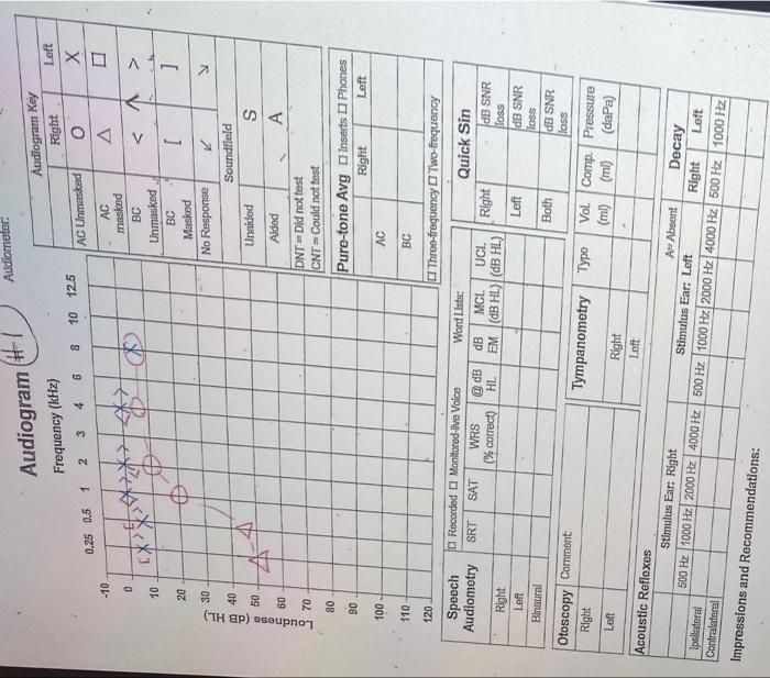 Solved Interpret the audiogram. A. The Air conduction | Chegg.com