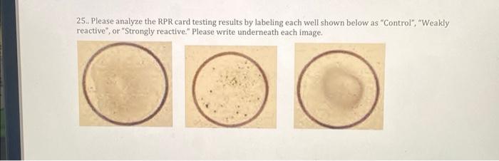 Solved 25.. Please analyze the RPR card testing results by | Chegg.com