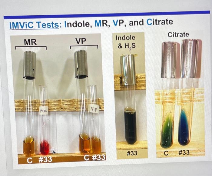 Solved IMVIC Tests: Indole, MR, VP, and Citrate Citrate MR | Chegg.com