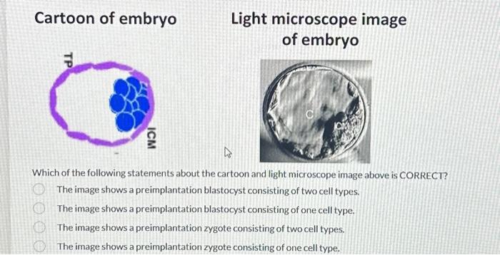 Solved Cartoon of embryo Light microscope image of embryo | Chegg.com