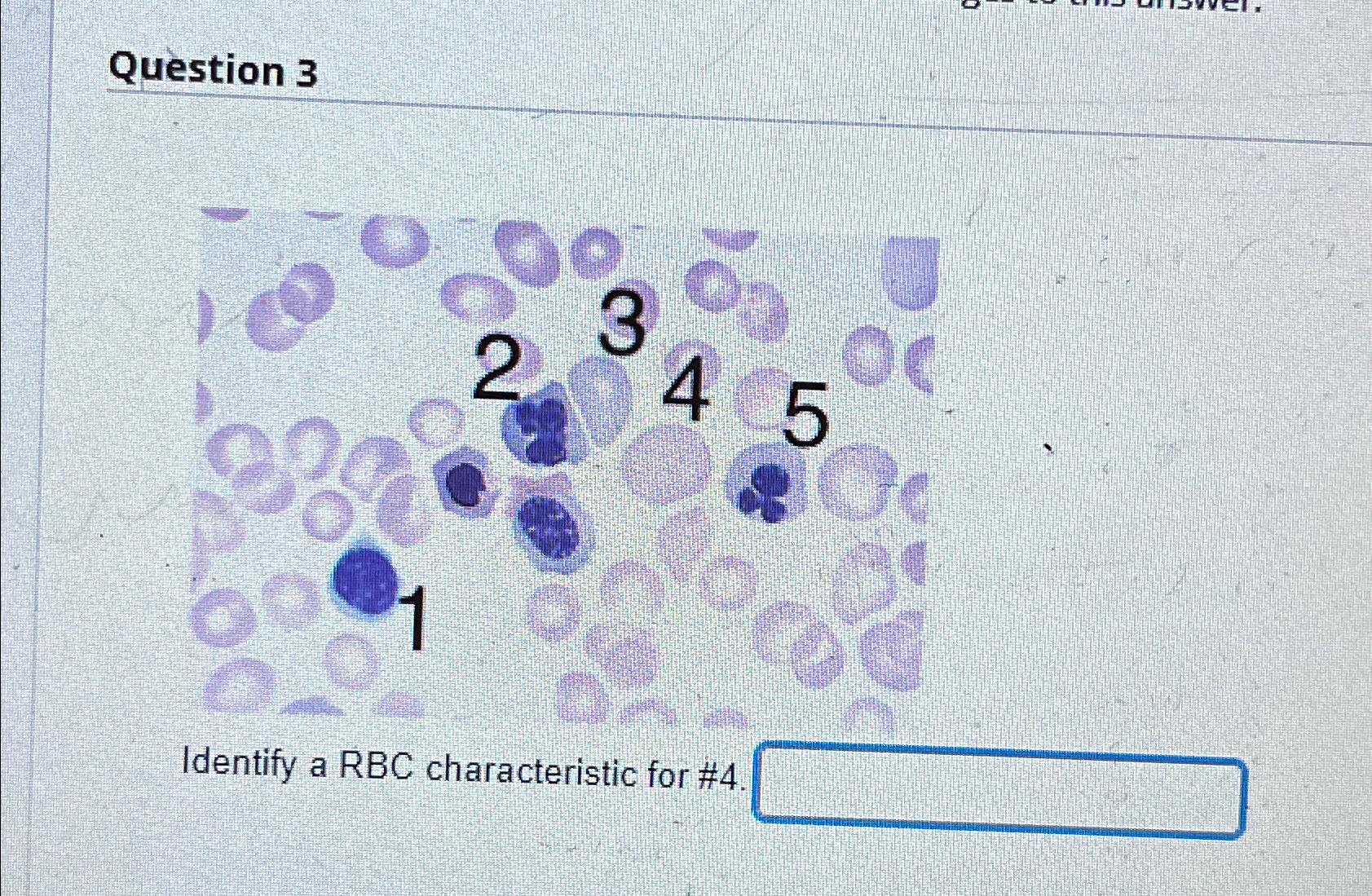 Solved Question 302e350Identify a RBC characteristic for #4. | Chegg.com