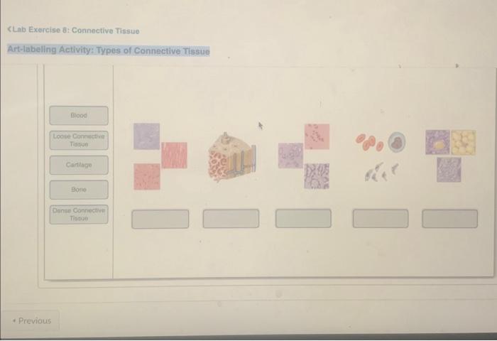 Solved Art-labeling Activity: Types of Connective Tissue | Chegg.com