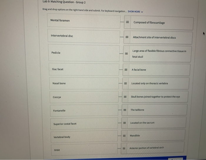 Solved Lab 9: Matching Question - Group 2 Drag and drop | Chegg.com