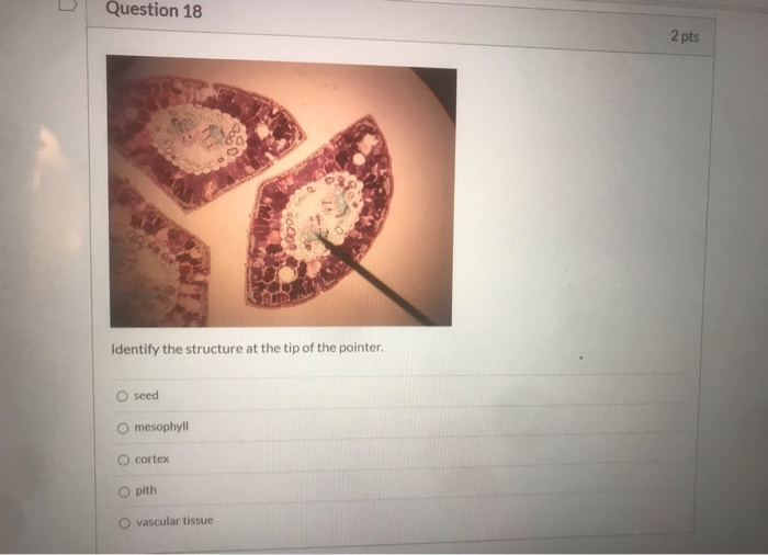 Solved Question 18 2 pts Identify the structure at the tip | Chegg.com
