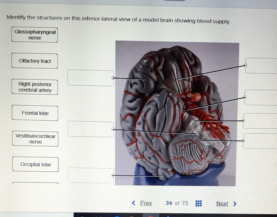 Solved Identify the structures on this inferior-lateral view | Chegg.com